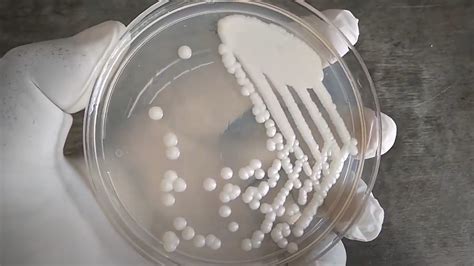 Cryptococcus Neoformans Introduction Morphology Pathogenecity Lab