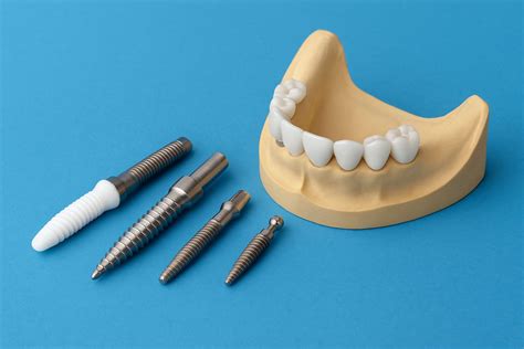 Mga Uri Ng Dental Implants Alamin Ang Tungkol Sa Lahat Ng Uri Ng Dental Implants Lavin Dental