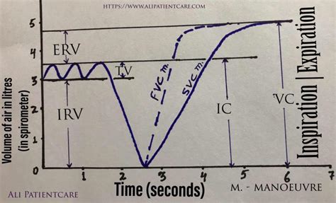 This A Graph Representing Volume Time Curve On Spirometry It Shows Forced Vital Capacity Fvc