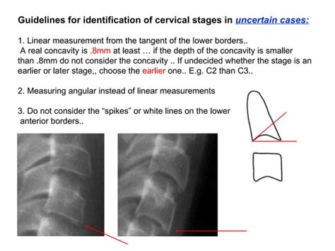Cvm Method Ppt