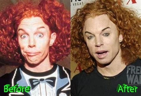Carrot Top Before And After Steroids