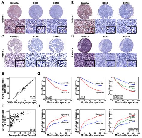 Expression And Prognostic Value Of Sema3a And Tams In Carcinoma Samples
