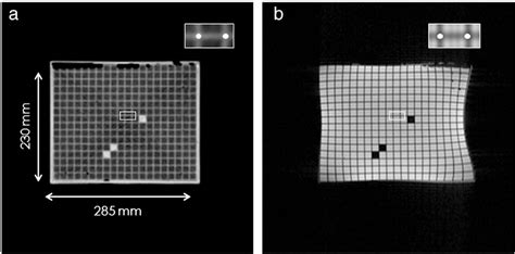 Figure 1 From Characteristics Of Geometric Distortion Correction With Increasing Field Of View