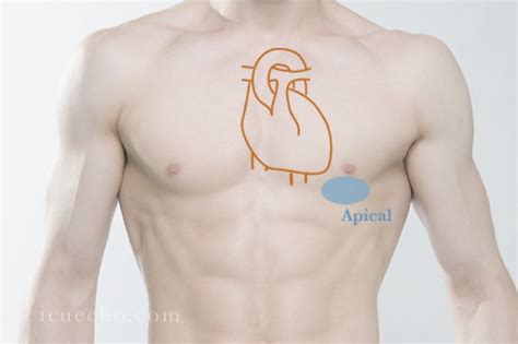 Apical 2 Chamber Icu And Echo