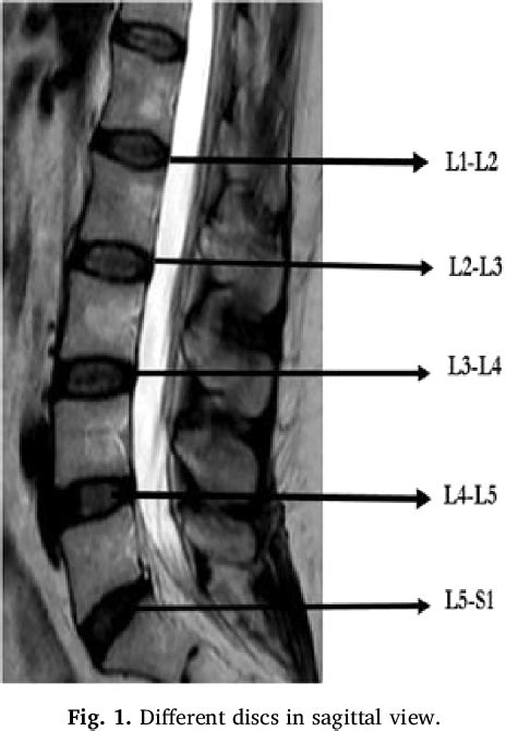 Figure 3 From Lumbar Spine Discs Classification Based On Deep Convolutional Neural Networks