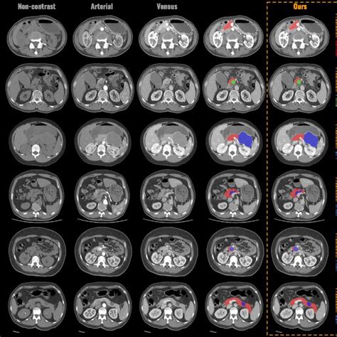Examples Of Classification And Segmentation Outputs From Our Mdpformer