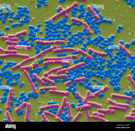 Haemolytic Streptococcus And E Coli Coloured Scanning Electron Micrograph Sem Streptococci