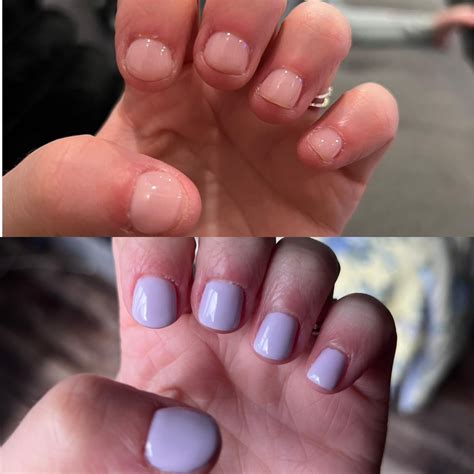 One Month Progress Rnailbiting