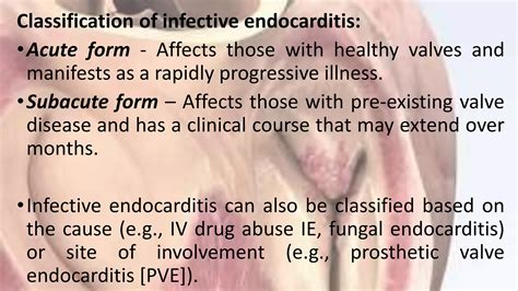 Endocarditis And Its Management Pptx