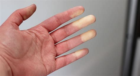 Blue And White Fingers