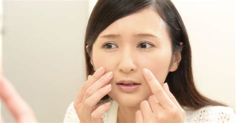 ស្បែកយារធ្លាក់ក្រោយសម្រាល សាកអនុវត្តតិចនិក ៥ នេះ Khmerload Cambodia Latest News