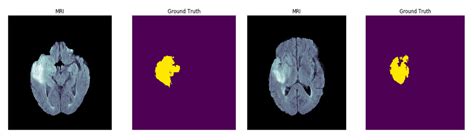 神经网络 医学图像分割 建立用于生物医学图像分割的网络架构 csdn博客