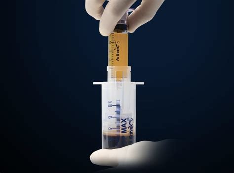 Arthrex Acp Max Ultimate Joint And Tendon Treatment Sport Doctor London