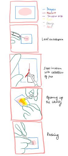 Medicowesome Incision And Drainage