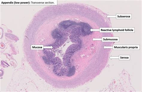 Appendix Normal Histology Nus Pathweb Nus Pathweb