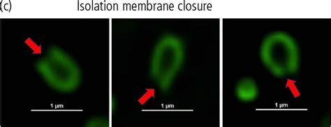 High Sensitivity Confocal Microscope Detector Nsparc Enables Live