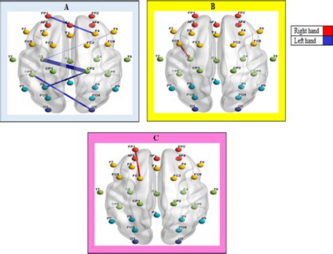 Significant Differences Of The Pli Values In Dynamic Touch Between The