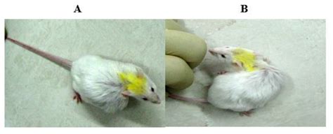 Dendrosomal Curcumin Decrerase The Tumor Size In Mice Model Of