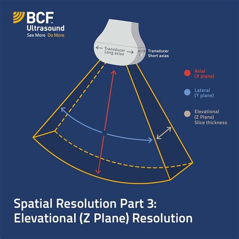 Bcf Ultrasound Spatial Resolution P 3 Elevational Z