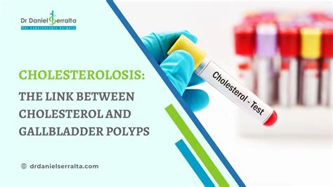 Cholesterol And Gallbladder Polyps Causes Risks And Treatments