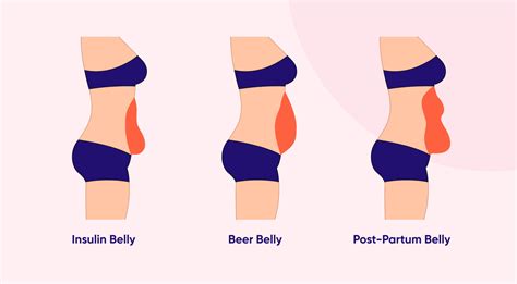 Types Of Bellies And How To Get Rid Of Them Kompanion