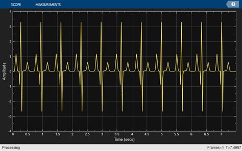 Signal Visualization And Measurements In Matlab Matlab And Simulink