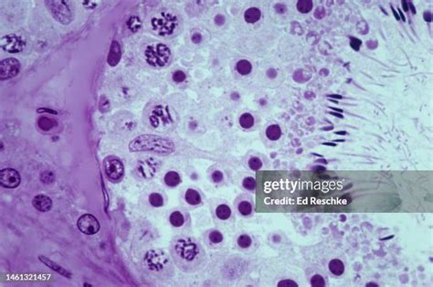 Interstitial Cell Photos And Premium High Res Pictures Getty Images