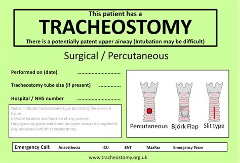 Keeping Patients Safe During Emergency Tracheostomy Management