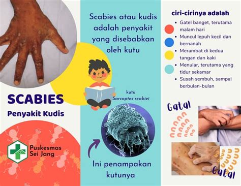 Scabies Pdf