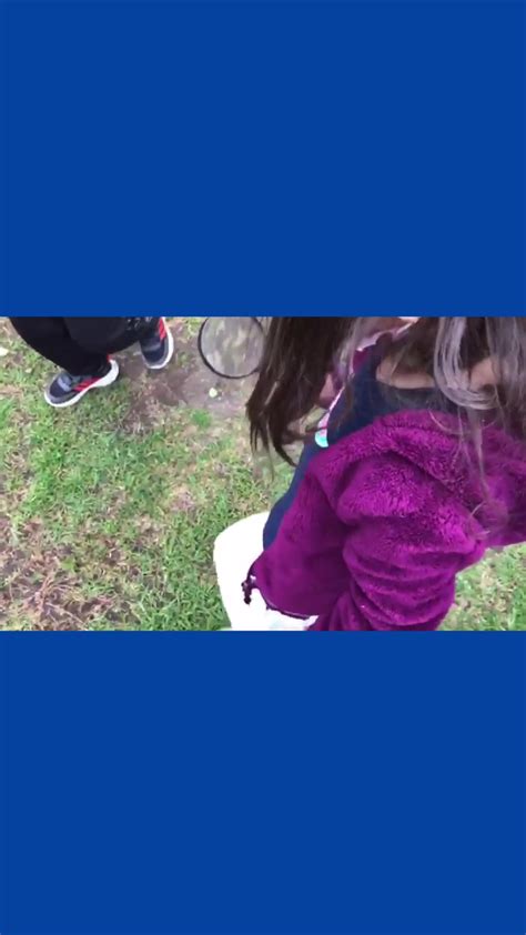 🦵la Motricidad Gruesa Forma Parte De La Psicomotricidad Infantil Que