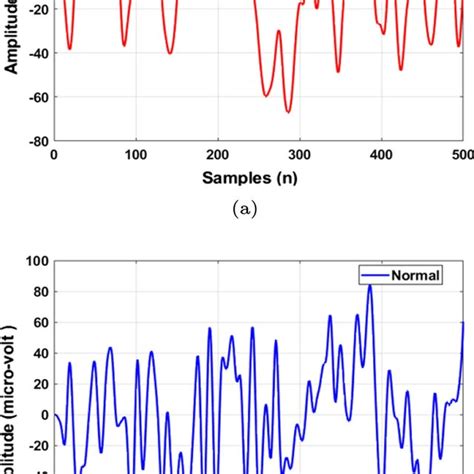 A Sample 10 IMFs For A Depression EEG Signal B Normal EEG Signal