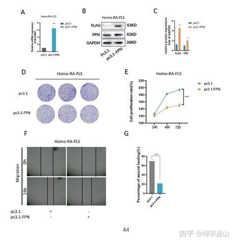 安徽医科大学使用rfectpm Prime原代细胞核酸转染试剂成功转染人和大鼠的膝关节原代成纤维滑膜细胞（fls） 知乎