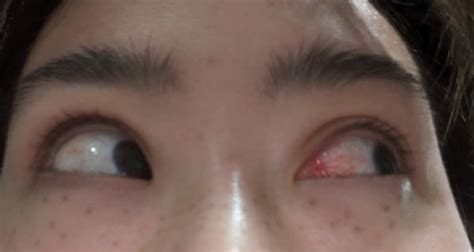 Brian S Boxer Wachler Md Updated June 2026 50 Photos And 115