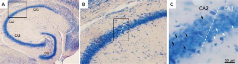Histological Assessment Of Hippocampal Ca1 Pyramidal Neuron Numbers