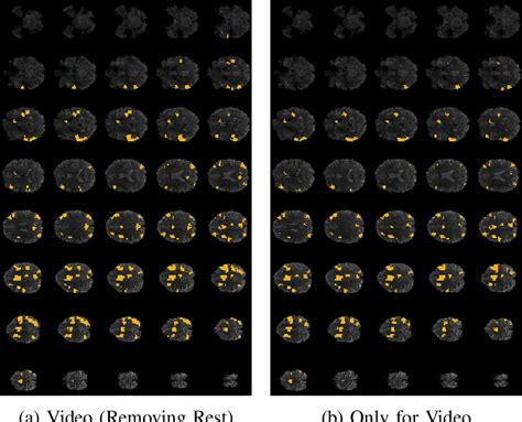 Figure 4 From Analysis Of Brain Fmri Data Via Topological Data