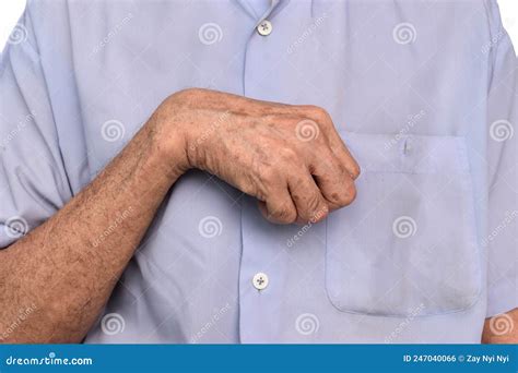 Rigidez Muscular De Mano Y Flexi N De Dedos Del Hombre Asi Tico Foto De