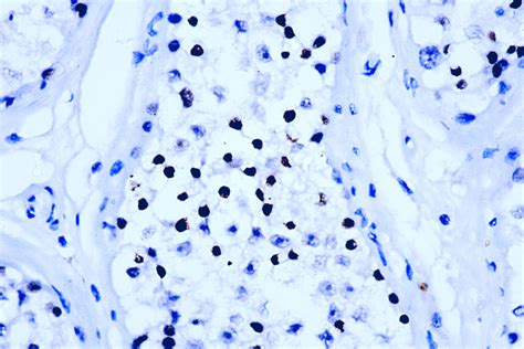 Prame Antibody For Ihc Detection Anti Prame Biogenex