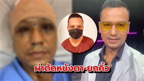 ไท ธนาวุฒิ ขึ้นเขียงศัลยกรรมหนังตา ยกคิ้ว เผยเหตุตัดสินใจไม่ใช่เพราะเสริมหล่อ