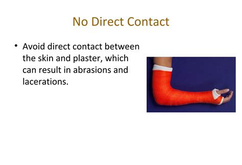 Casting And Splinting Principles And Common Pitfalls Ppt