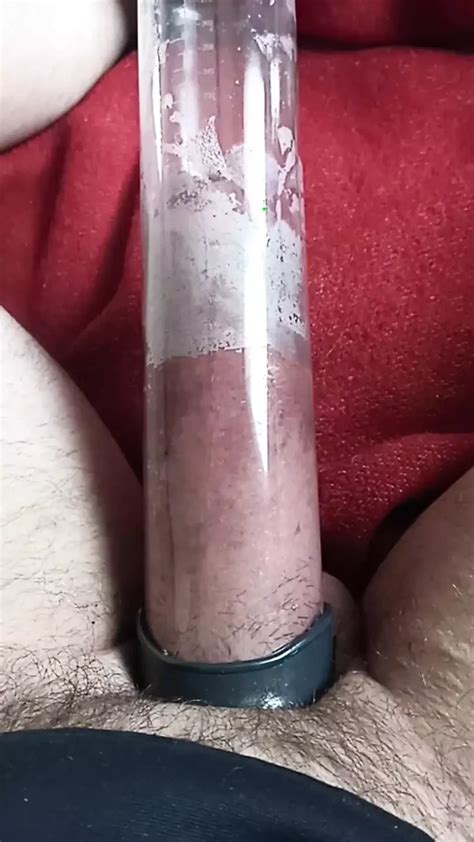 Eric S Exploded Ass Gay Amateur Amateur Porn Feat Greddy Gourmande XHamster