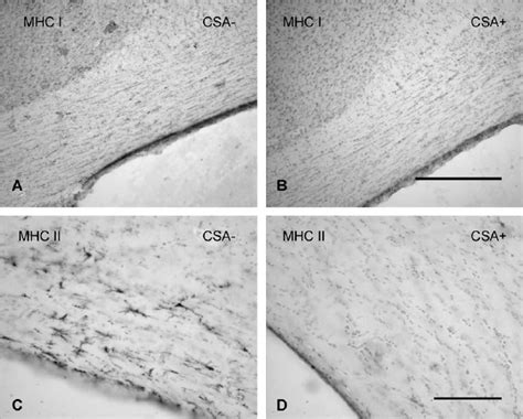 Brightfield Photomicrographs Showing Mhc Classes I And Ii Expression In Download Scientific