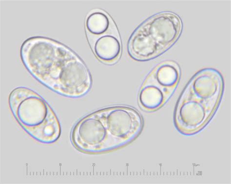 Pachyella clypeata カバイロチャワンタケ