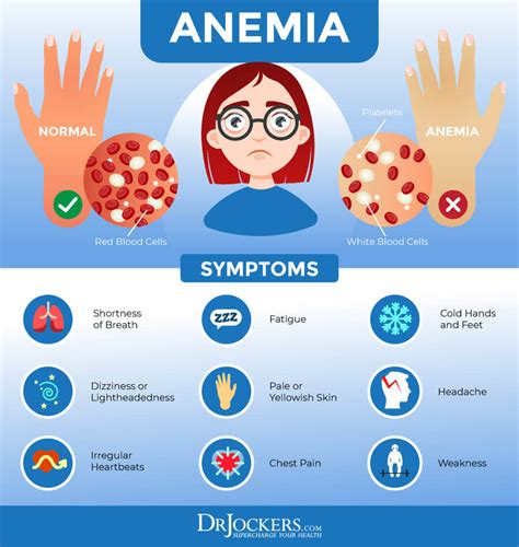 Anemia Symptoms Types Causes Treatment My Xxx Hot Girl