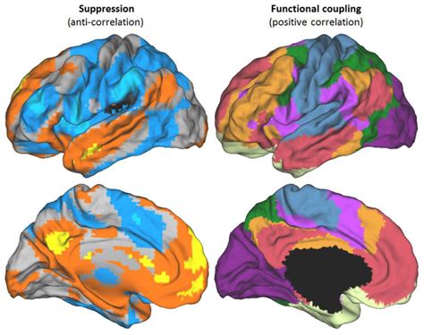 Different Criteria For Defining Brain Networks Functional Networks Download Scientific Diagram