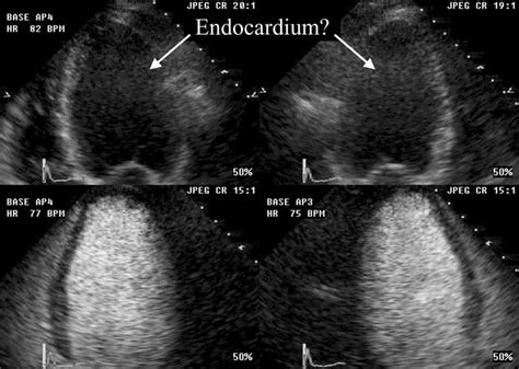 Visualisation Of Endocardial Border In Four And Three Chamber Images Download Scientific