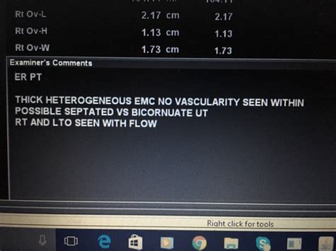 Abnormal Uterus Glow Community