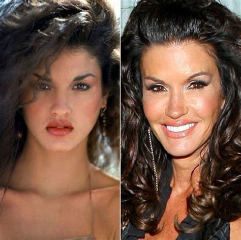Janice Dickinson Life With Plastic Surgery