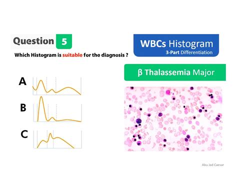 Wbc Histogram Pdf