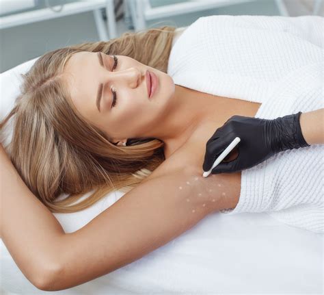 Effective Hyperhidrosis Treatment At Mhm Aesthetics