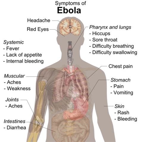 Ebola Virus Structure Genome Replication Pathogenesis Biology